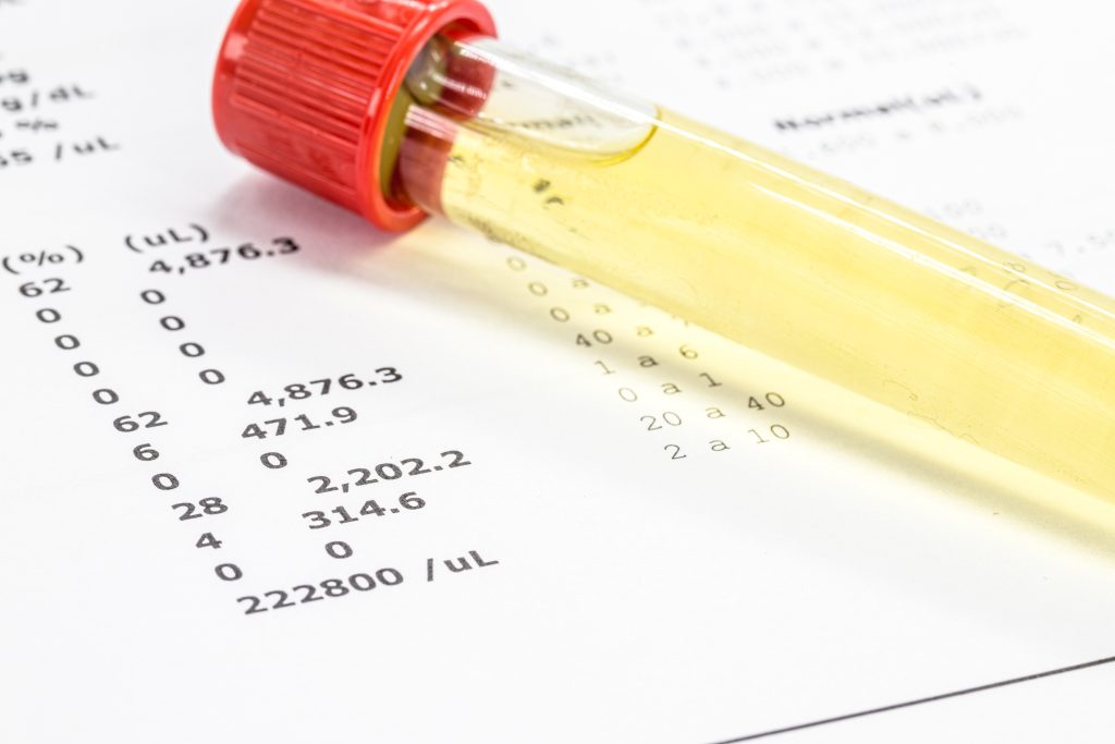 Understanding Heavy Metal Testing: Why Accurate Results Matter ...